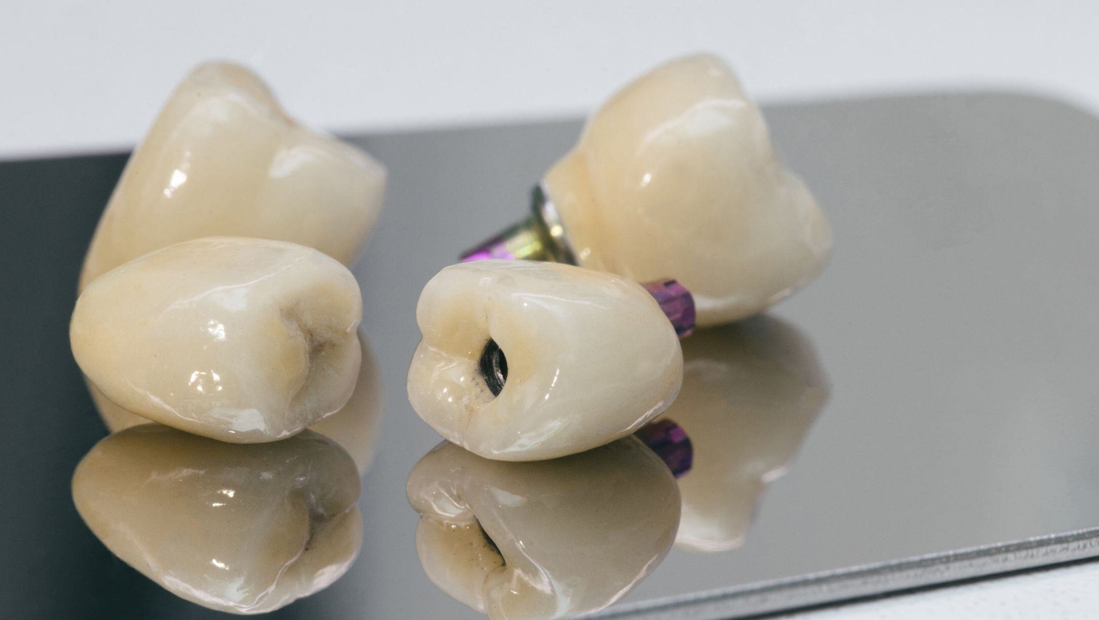 Implant Solutions | Fast Turnaround & Custom Abutments | Dental Implant Lab